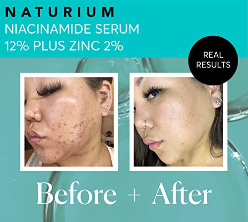 Naturium Niacinamide Face Serum 12% Plus Zinc 2%, Hyaluronic Acid & Vitamin E, Pore Minimizer, Discoloration & Aging Skin Treatment, 1 oz