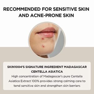 SKIN1004 Madagascar Centella Asiatica Ampoule Facial Serum 3.38 fl.oz(100ml) | 100% Centella Asiatica Extract | Soothes Acne Prone and Sensitive Skin