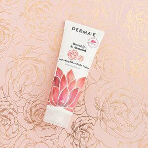 DERMA-E Rosehip and Almond Anti-Aging Shea Body Lotion – Vegan Collagen, Retinol and Vitamin E Moisturizer for Dry Skin – Gently Scented Cruelty Free Moisturizing Cream, 8 oz