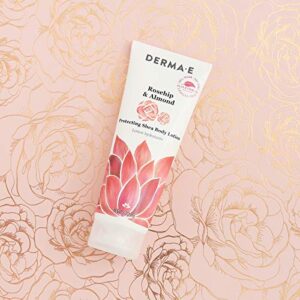 DERMA-E Rosehip and Almond Anti-Aging Shea Body Lotion – Vegan Collagen, Retinol and Vitamin E Moisturizer for Dry Skin – Gently Scented Cruelty Free Moisturizing Cream, 8 oz