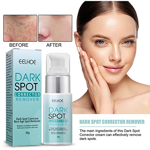 BIERELAOZI 4Pack The Spot Cream for Face,Dark Spot Remover Cream,Freckle Remover Cream,Age Spot Remover for Hands&Black Neck,Face Cream for Man & Woman