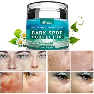 paradise emerald dark spot remover for face, hyperpigmentation treatment, melasma, freckle, sun spots removal for all skin types dark spot corrector for men and women