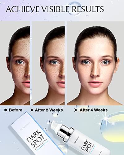 EnaSkin Professional Dark Spot Remover for Face and Body, Perfecting Dark Spot Corrector Serum Treatment, Melasma, Freckle, Sun Spot, Hyperpigmentation, Blemish Spot, Brown Spots for Men&Women, Advanced Formula with Safe Ingredients 4-Butylresorcinol, Koj