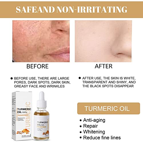 2022 New Turmeric Dark Spot Corrector Serum，Natural Turmeric Dark Spot Corrector Serum for Face， Skin Care Moisturizing Repair Serum(2PCS-60ml)