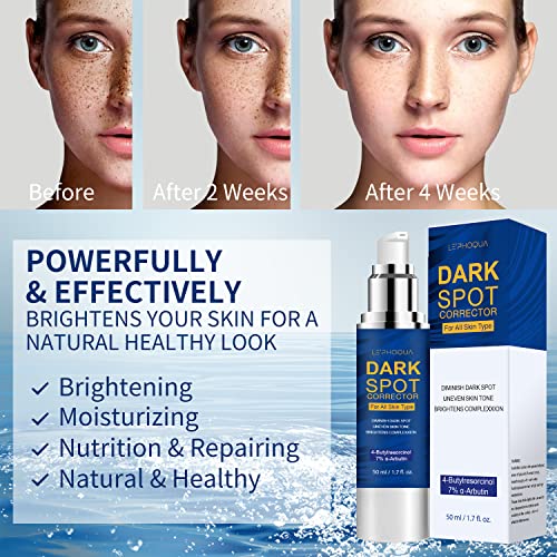 Advanced Dark Spot Remover For Face & Body, Dark Spot Corrector Cream For Face, Fade Cream For Dark Spots & Sun Spot Remover, Blemish Spot, Melasma & Hyperpigmentation Treatment With Nicotinamide & 4-Butylresorcinol