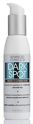 Advanced Clinicals Dark Spot Corrector Facial Cream W/Shea Butter & Hyaluronic Acid Skin Care Face Lotion. Anti Aging Moisturizer Targets Dark Spots, Wrinkles, Age Spots & Uneven Skin Tone, 4 Fl Oz