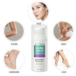 Dark Spot Corrector for Face, Hyperpigmentation Treatment for Face, Dark Spot Remover for Face, Hyperpigmentation Treatment, Melasma treatment for face, Sun Spot Remover & Blemish Remover, Crema Para Las Manchas De La Cara