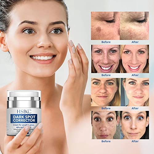 Dark Spot Remover for Face and Body, Dark Spot Corrector for Face, Sun Spots Melasma Cream and Freckle Remover- Formulated with Arbutin, Niacinamide & Vitamin E