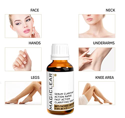 Luxury Dark spot remover for Face and Body Serum - Age spot corrector Acne scar - Anti aging - Bleaching Vitamin C organic Swiss brand Magiclear 30 ml