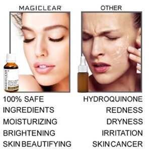 Luxury Dark spot remover for Face and Body Serum - Age spot corrector Acne scar - Anti aging - Bleaching Vitamin C organic Swiss brand Magiclear 30 ml