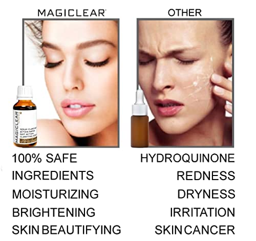 Luxury Dark spot remover for Face and Body Serum - Age spot corrector Acne scar - Anti aging - Bleaching Vitamin C organic Swiss brand Magiclear 30 ml