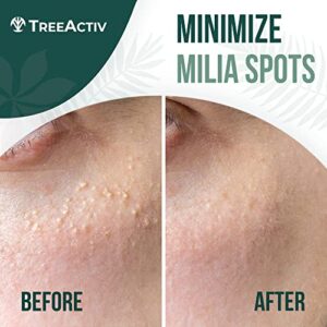 Treeactiv Overnight Milia Spot Treatment 0.5oz, Improves Milia Overnight, Effectively Treat Milia Blemishes in 2 Weeks, Natural Milia Treatment, 120+ Uses