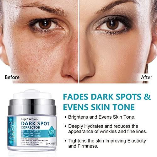 Dark Spot Remover For Face, Dark Spot Corrector and Remover, Sun Spots Melasma Freckle Remover, Packed with vitamins and natural extracts to treat dark spots, age spots, or sunspots (A)