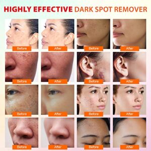 Dark Spot Corrector, Large 65 ML Dark Spot Remover for Face and body, Dark Spot Serum, Ideal for Fine Lines, Uneven Skin Tone, Nutrient Rich Formula with Squalene, Deep Hydration Cream