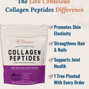 Collagen Peptides Powder - Naturally-Sourced Hydrolyzed Collagen Powder - Hair, Skin, Nail, and Joint Support - Type I & III Grass-Fed Collagen Supplements for Women and Men - 41 Servings - 16oz