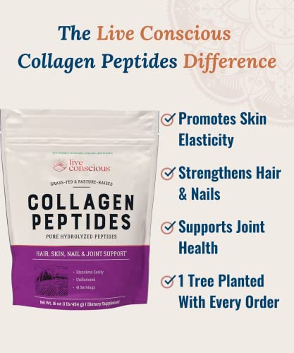 Collagen Peptides Powder - Naturally-Sourced Hydrolyzed Collagen Powder - Hair, Skin, Nail, and Joint Support - Type I & III Grass-Fed Collagen Supplements for Women and Men - 41 Servings - 16oz