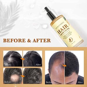 Biotin & Castor oil & Rosemary Oil for Hair Growth for Women, hair loss treatments, hair oil for dry damaged hair and growth, Hair Growth Serum for Thicker Longer Fuller Healthier Hair, All Natural Vitamin Rich Treatment