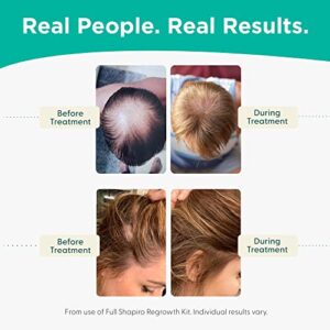 Hair Loss Leave-In Daily Foam | DHT Fighting Vegan Formula for Thinning Hair Developed by Dermatologists | Experience Healthier, Fuller & Thicker Looking Hair – Shapiro MD | 1-Month Supply