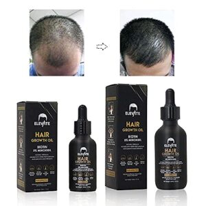 ELEVATE Hair Growth Oil - Biotin Hair Growth Serum & 5% Minoxidil Treatment for Stronger Thicker Longer Hair – Natural Hair Growth Thickening Treatment - Stop Thinning & Hair Loss for Men & Women 1oz