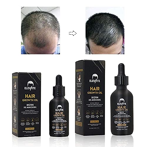 ELEVATE Hair Growth Oil - Biotin Hair Growth Serum & 5% Minoxidil Treatment for Stronger Thicker Longer Hair – Natural Hair Growth Thickening Treatment - Stop Thinning & Hair Loss for Men & Women 1oz