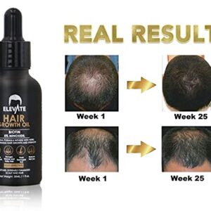 ELEVATE Hair Growth Oil - Biotin Hair Growth Serum & 5% Minoxidil Treatment for Stronger Thicker Longer Hair – Natural Hair Growth Thickening Treatment - Stop Thinning & Hair Loss for Men & Women 1oz