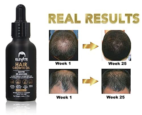 ELEVATE Hair Growth Oil - Biotin Hair Growth Serum & 5% Minoxidil Treatment for Stronger Thicker Longer Hair – Natural Hair Growth Thickening Treatment - Stop Thinning & Hair Loss for Men & Women 1oz