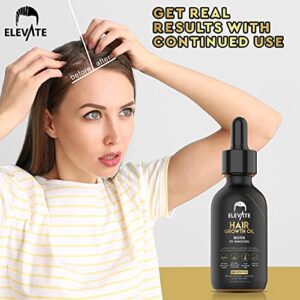 ELEVATE Hair Growth Oil - Biotin Hair Growth Serum & 5% Minoxidil Treatment for Stronger Thicker Longer Hair – Natural Hair Growth Thickening Treatment - Stop Thinning & Hair Loss for Men & Women 1oz