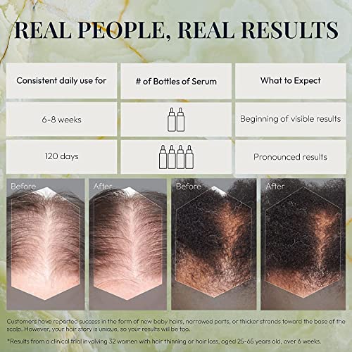 Revela Hair - The Hair Revival Serum - Dermatologist Approved Lightweight Hair Loss & Hair Thinning Serum - Scalp & Hair Follicle Penetration for Fast, Visible Results - For All Hair Types - 40ml / 1.4 Fl. Oz, 2 Pack