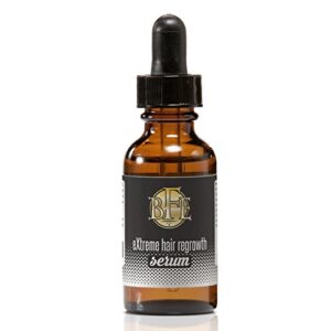 hair regrowth serum- maximum strength dht blocker. repairs & stimulates new follicle hair growth. grow stronger, thicker, fuller, longer, healthier hair. for men & women with no side effects.