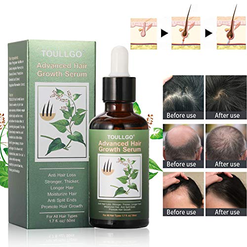 Hair Growth Serum, Hair Loss Treatments, Hair Serum, Hair Growth Oil for Thicker Longer Fuller Healthier Hair, Help Hair Follicle Growth, Prevent Hair Loss and Thinning, With Natural Vitamin Rich Trea