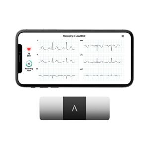 kardiamobile 6-lead personal ekg monitor – six views of the heart – detects afib and irregular arrhythmias – instant results in 30 seconds – works with most smartphones – fsa/hsa eligible