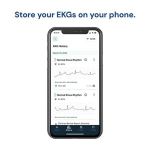 KardiaMobile 1-Lead Personal EKG Monitor – Record EKGs at Home – Detects AFib and Irregular Arrhythmias – Instant Results in 30 Seconds – Easy to Use – Works with Most Smartphones - FSA/HSA Eligible