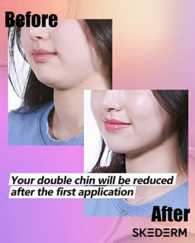 SKEDERM Lifting Patch Peptide | V Shaped Slimming Face Mask Double Chin Reducer V Line Lifting Mask