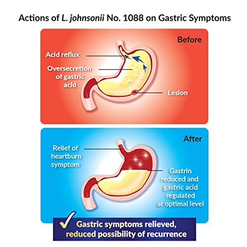 GASTRICELL - Eliminate H. Pylori, Relieve Acid Reflux and Heartburn, Regulate Gastric Acid - Targets The Root Cause of Recurring Gastric Problems, Natural Defence Against Gastric Distress -30 sachets