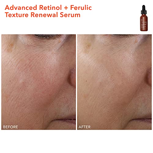 Dr Dennis Gross Celebrate Smooth Kit: Advanced Retinol + Ferulic Texture Renewal Serum, Triple Correction Eye Serum & Intense Wrinkle Cream (0.5 fl oz each)