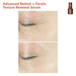 Dr Dennis Gross Celebrate Smooth Kit: Advanced Retinol + Ferulic Texture Renewal Serum, Triple Correction Eye Serum & Intense Wrinkle Cream (0.5 fl oz each)