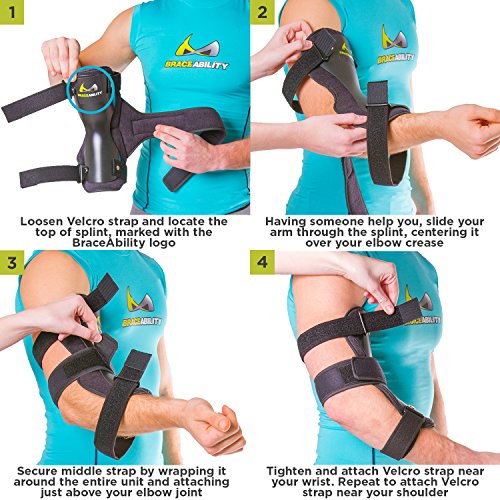 BraceAbility Cubital Tunnel Syndrome Elbow Brace | Splint to Treat Pain from Ulnar Nerve Entrapment, Hyperextended Elbow Prevention and Post Surgery Arm Immobilizer - S (Small/Medium)