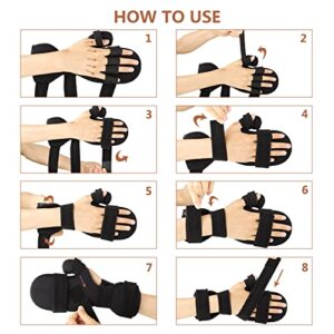 Scurnhau Resting Hand Brace, Soft Stroke Hand Splint Night Support for Finger Contractures, Hand Immobilizer for Carpel Tunnel Wrist Pain, Muscle Atrophy, Arthritis, Tendonitis, Metacarpal Breaks