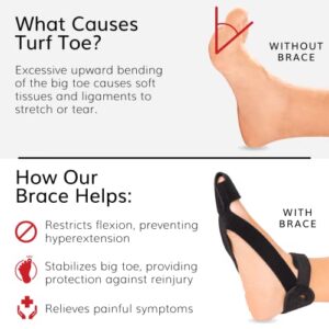 BraceAbility Turf Toe Brace - New, Adjustable Medical-Grade Foot Orthotic for Sprained and Hyperextended Big Toe Injury Treatment and Pain Relief - Perfect Splint, Plate, and Taping Alternative (XL)