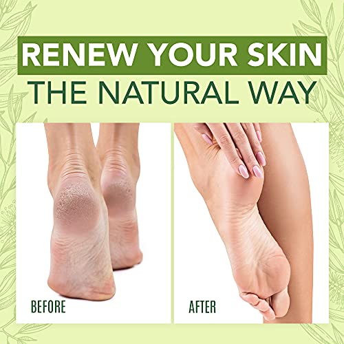 Tea Tree Oil Foot Cream - Instantly Hydrates and Moisturizes Cracked or Callused Feet - Rapid Relief Heel Cream - Natural Treatment Helps & Soothes Irritated Skin, Athletes Foot, Body Acne