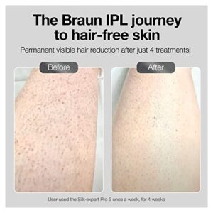 Braun IPL Long-lasting Hair Removal System for Women and Men, NEW Silk Expert Pro 3 PL3221, Head-to-toe Usage, for Body & Face, Alternative to Salon Laser Hair Removal, With 3 Extra Caps