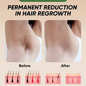 XSOUL At-Home IPL Hair Removal for Women and Men Permanent Hair Removal 999,999 Flashes Painless Hair Remover on Armpits Back Legs Arms Face Bikini Line, Corded