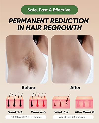 XSOUL At-Home IPL Hair Removal for Women and Men Permanent Hair Removal 999,999 Flashes Painless Hair Remover on Armpits Back Legs Arms Face Bikini Line, Corded