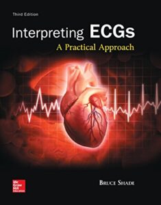 interpreting ecgs: a practical approach