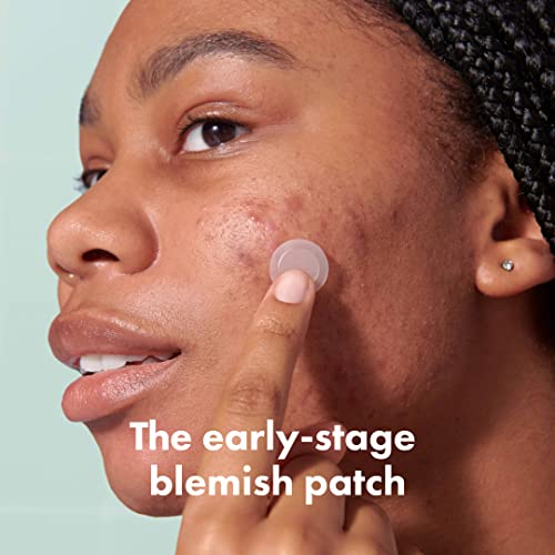 Mighty Patch Micropoint for Blemishes from Hero Cosmetics - Hydrocolloid Acne Spot Treatment Patch for Early Stage Zits and Hidden Pimples, 395 Micropoints (8 Patches)