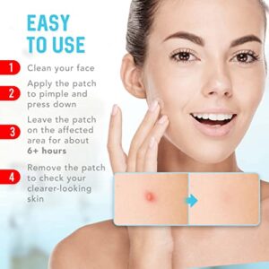 Pimple Patches (120 Pack), Hydrocolloid Acne Patches with Tea Tree Oil - Pimple Patches for Face - Zit Patch and Pimple Stickers - Hydrocolloid Acne Dots for Acne - Zit Patches - Acne