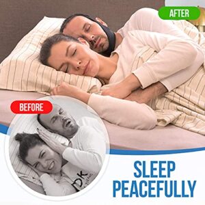 AVEELA Anti Snoring Chin Strap for CPAP Users | Large | Keep Mouth Closed While Sleeping | Adjustable Premium Snore Stopper Head Strap for Men and Women | Itch-Free Material for Uninterrupted Sleep