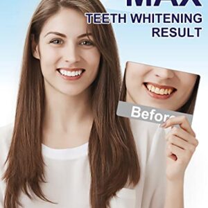 MySmile Teeth Whitening Kit Enhanced Teeth Whitener Flagship Version,10 Min 6 Month Supply Non-Sensitive Teeth Whitening Pen, Helps to Remove Stains from Coffee, Smoking, Wine, Soda, Tea