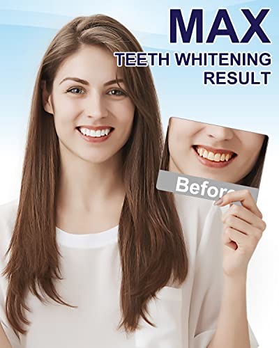 MySmile Teeth Whitening Kit Enhanced Teeth Whitener Flagship Version,10 Min 6 Month Supply Non-Sensitive Teeth Whitening Pen, Helps to Remove Stains from Coffee, Smoking, Wine, Soda, Tea