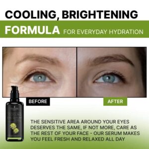 Eye Serum Under Eye Cream for Dark Circles and Puffiness – Cooling, Hydrating Under Eye Serum with Pure Fennel Extract – Eye Cream Anti Aging to Moisturize & Depuff – Zero Paraben Eye Gel by Vitavelle